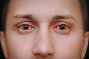What Causes Sticky Eyes| Banton Frameworks